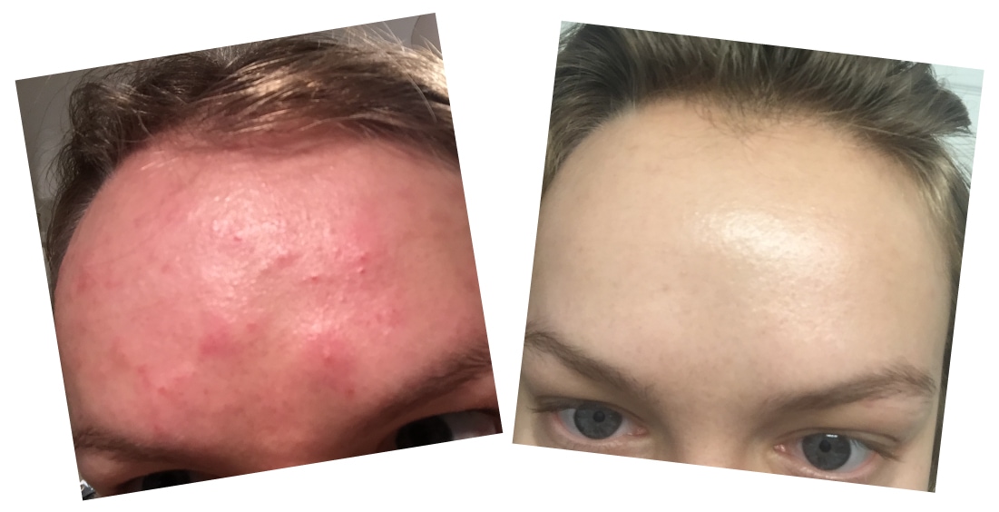 pop-about-page-before-and-after – olena beley.